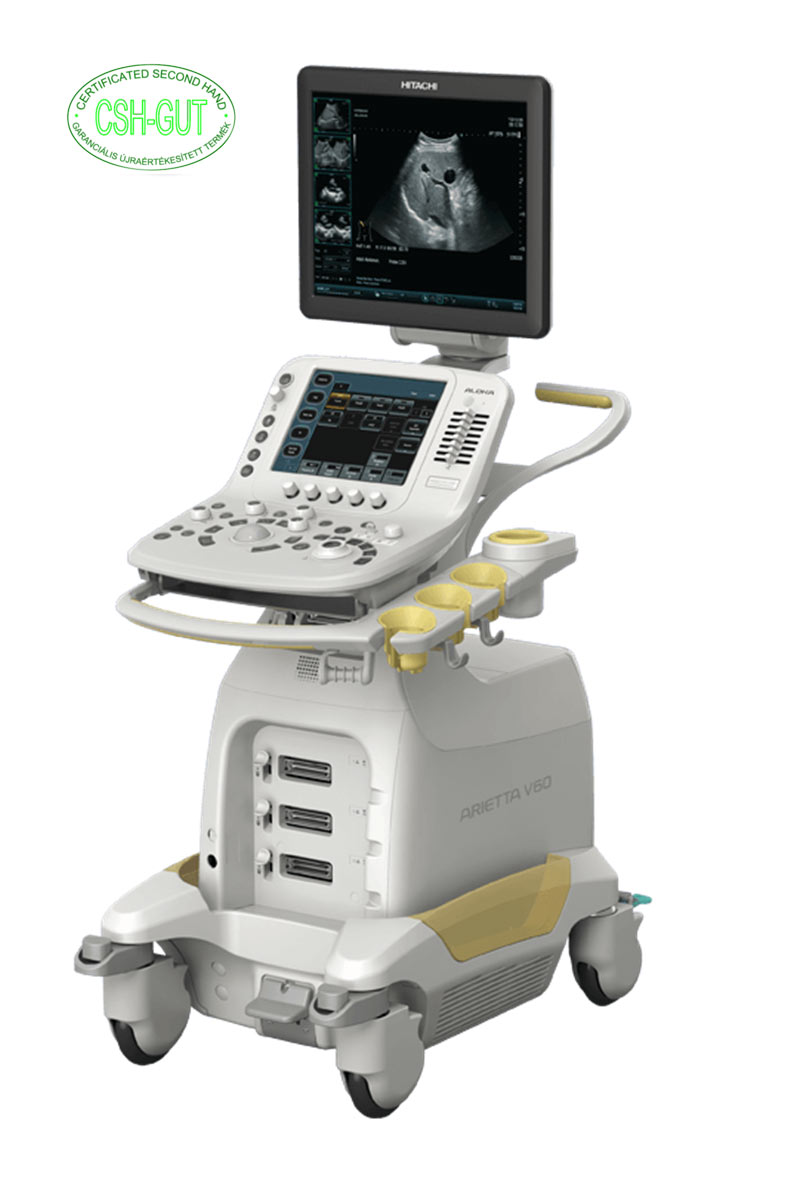 HITACHI ARIETTA V60 – Hyppo Labor